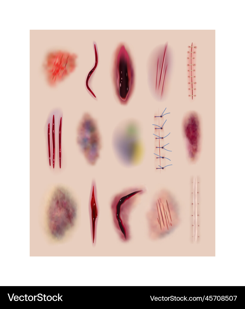 Bloody stitching cuts and wounds scars decent Vector Image