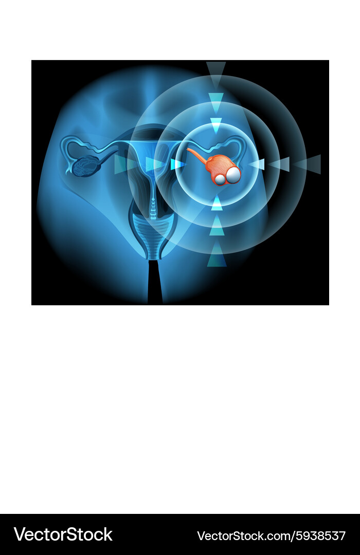 Ovarian diagram with focus Royalty Free Vector Image