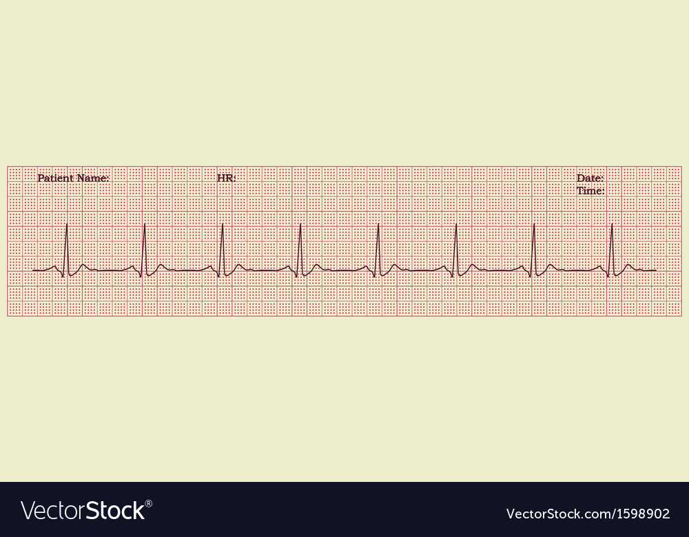 Cardiogram Royalty Free Vector Image - VectorStock