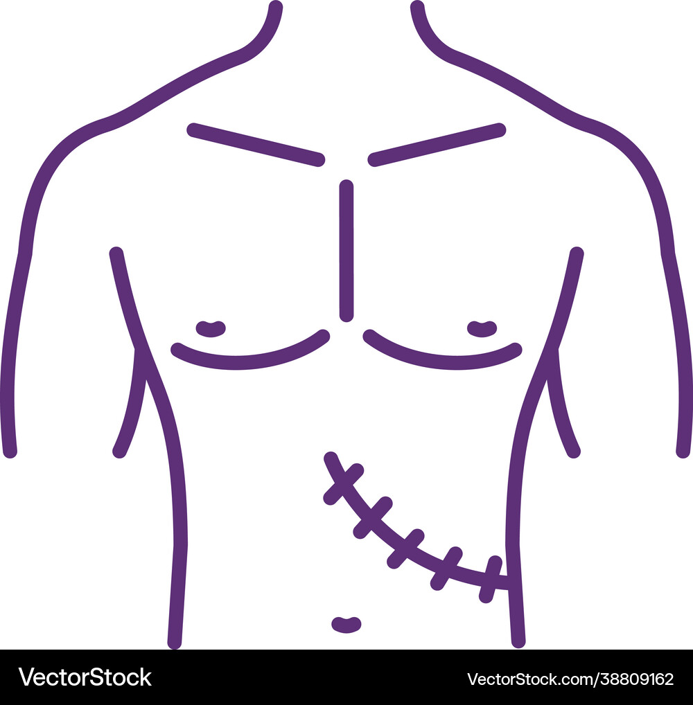 Removed organ aftermath rgb color icon Royalty Free Vector
