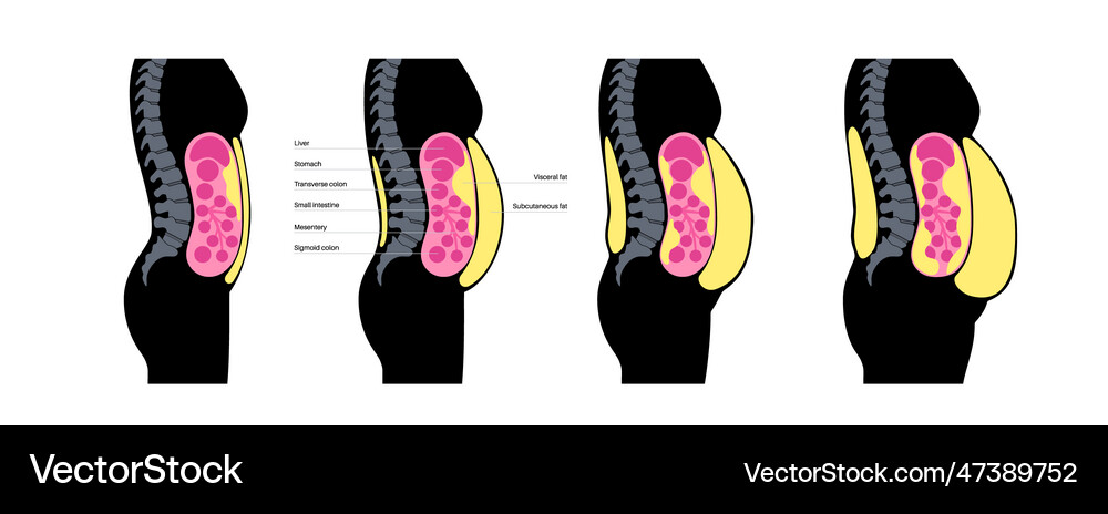 Visceral Fat Anatomy – Royalty-Free Vector | VectorStock