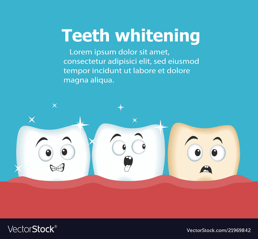 Professional teeth whitening Royalty Free Vector Image