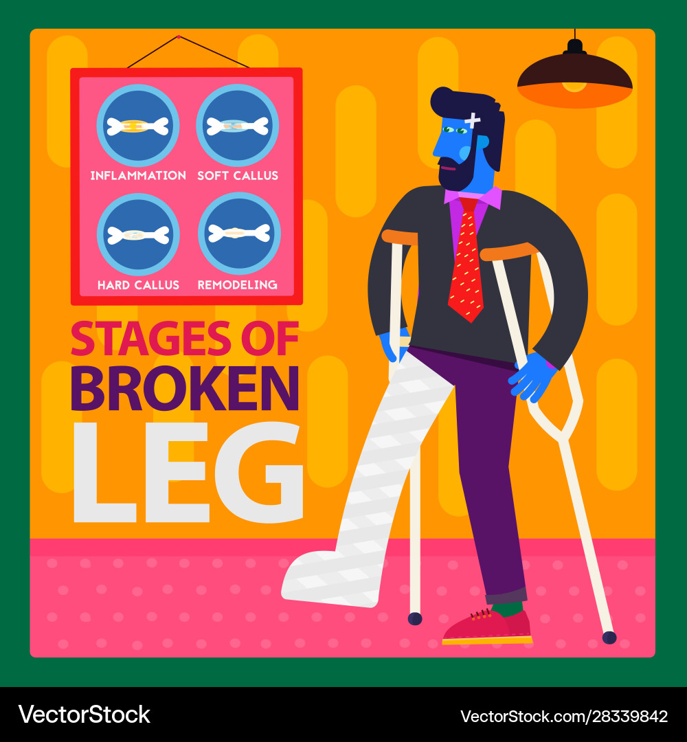 Stages bone fracture character cartoon Royalty Free Vector