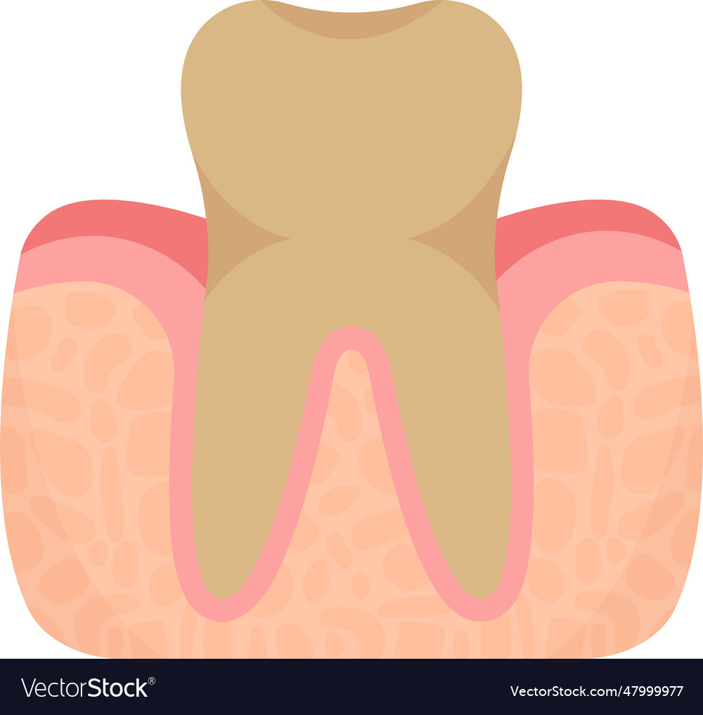 Yellow tooth problem Royalty Free Vector Image