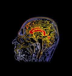 Topographic map mri of the human brain Royalty Free Vector