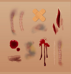 Dripping blood and set of Royalty Free Vector Image