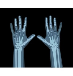 Skeletal system Royalty Free Vector Image - VectorStock