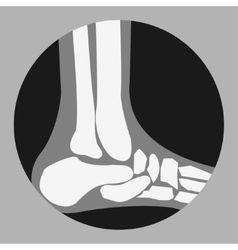 Open torn cut wound bruised foot and medical Vector Image