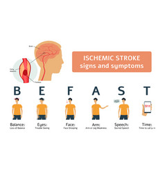 Ischemic stroke signs and symptoms infographic Vector Image
