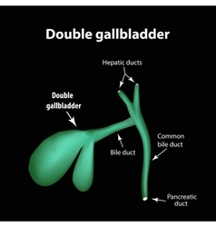 Double gall bladder pathology gallbladder Vector Image